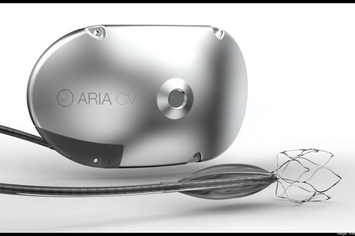 Aria CV Announces First Patient Successfully Implanted with Second ...